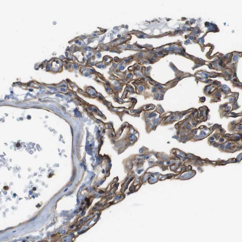 Anti-EMP2 Human Protein Atlas Antibody