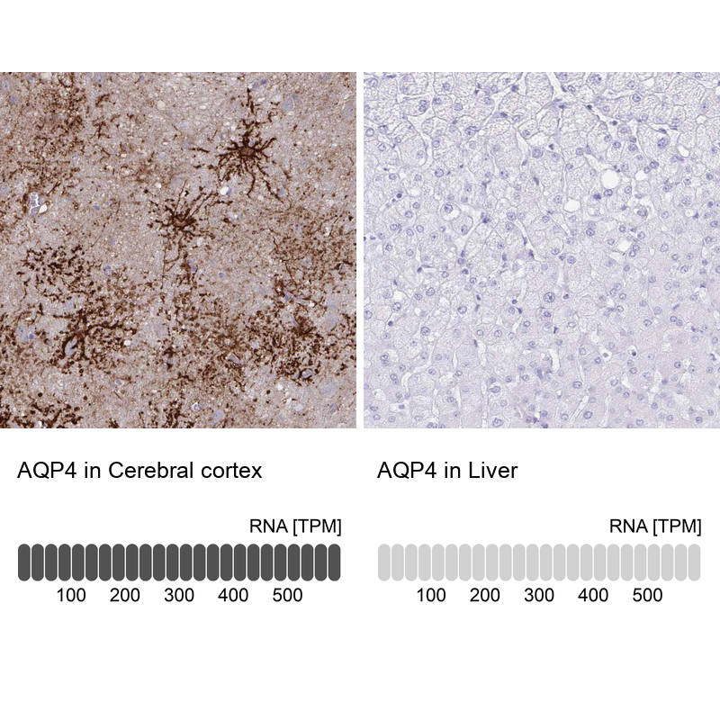 Rabbit Polyclonal Anti-AQP4 Antibody - Buy for research - Highly ...