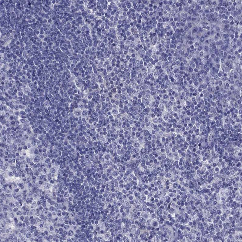 Anti-SLC16A8 Human Protein Atlas Antibody