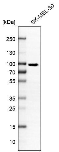 Rabbit Polyclonal Anti-SLC3A2 Antibody - Buy for research - Highly ...