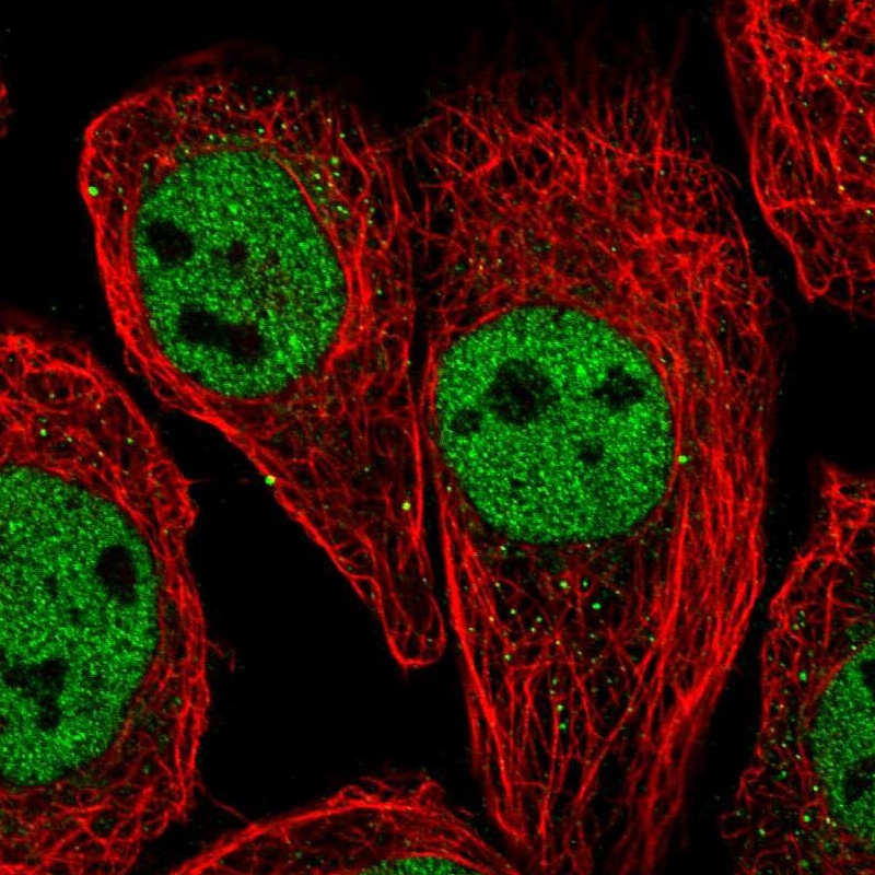 Anti-SMARCB1 Human Protein Atlas Antibody