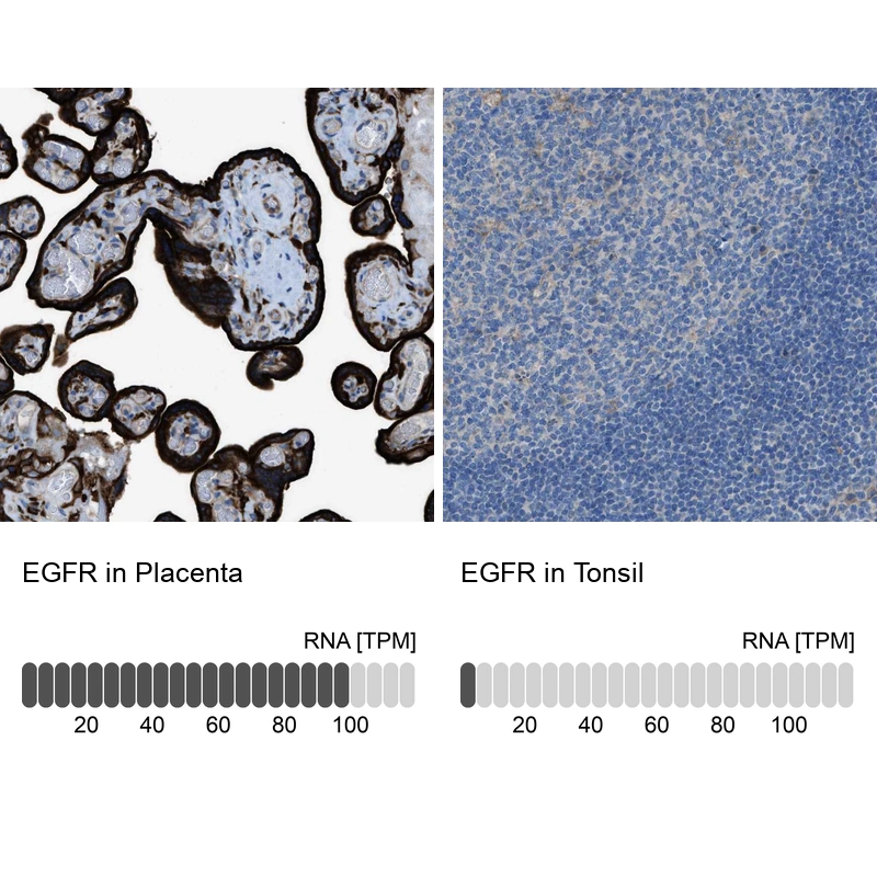 Anti-EGFR Human Protein Atlas Antibody
