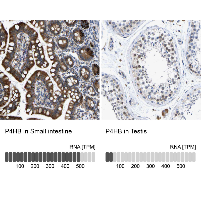 Anti-P4HB Human Protein Atlas Antibody