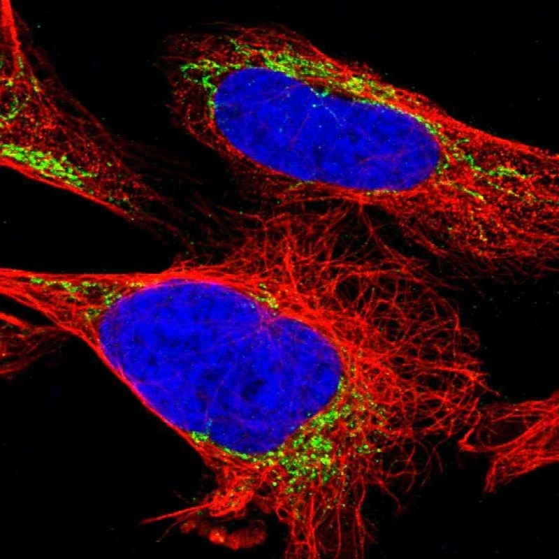 Anti-ETFA Human Protein Atlas Antibody