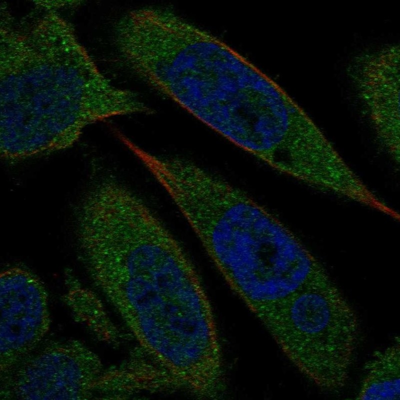 Rabbit Polyclonal Anti-BLVRA Antibody - Buy for research - Highly specific, rigorously validated ...