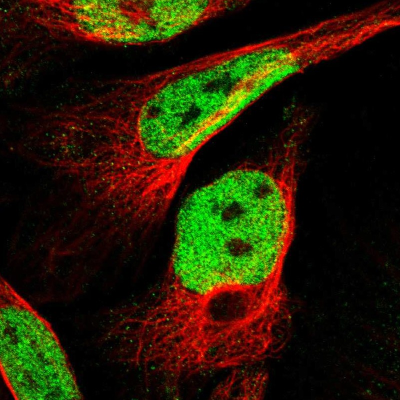 Rabbit Polyclonal Anti-INIP Antibody - Buy for research - Highly ...