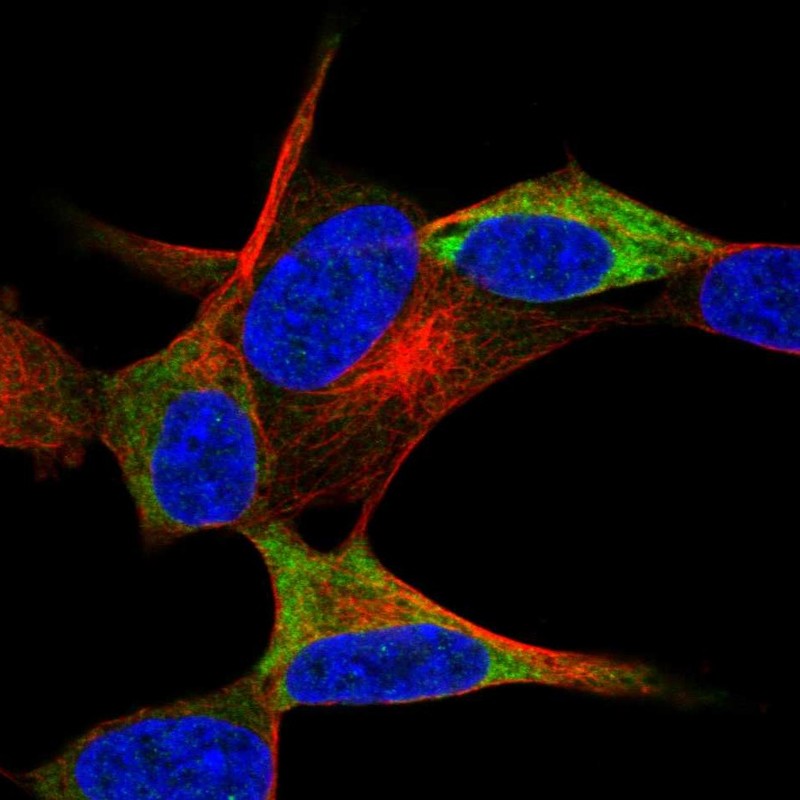 Rabbit Polyclonal Anti-NACAD Antibody - Buy for research - Highly ...