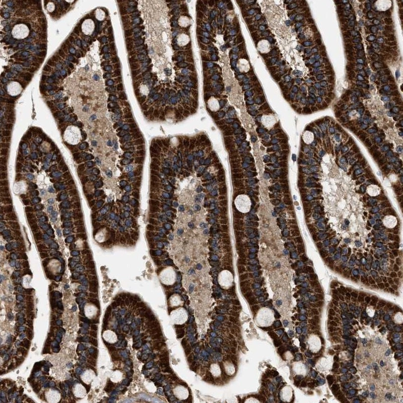 Anti-ZBTB26 Human Protein Atlas Antibody