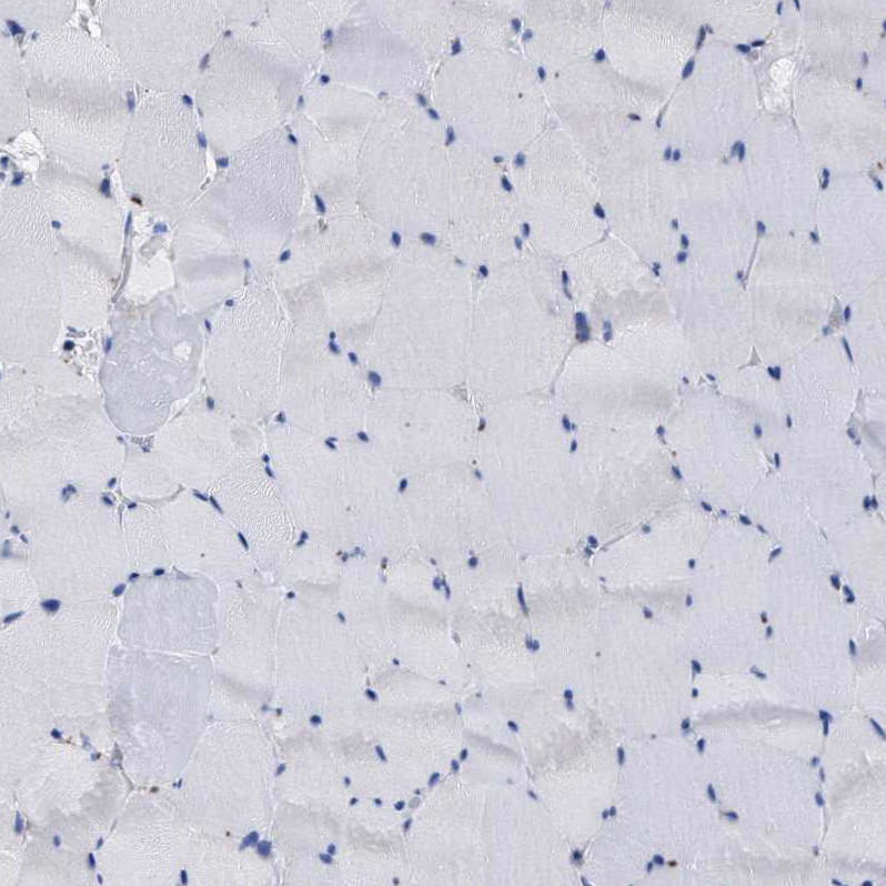 Rabbit Polyclonal Anti-PPT1 Antibody - Buy for research - Highly ...