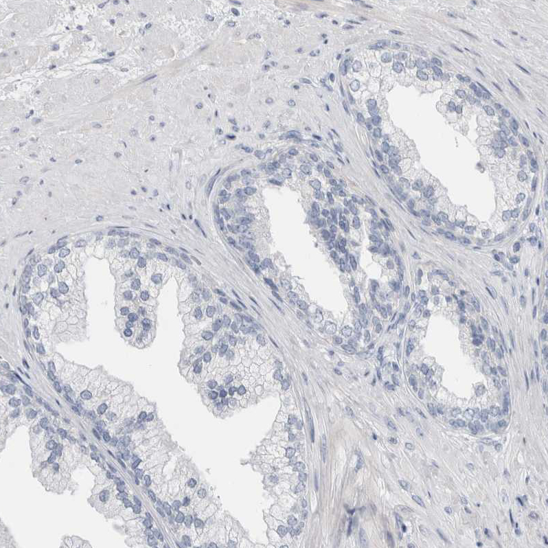 Rabbit Polyclonal Anti-CD55 Antibody - Buy for research - Highly ...