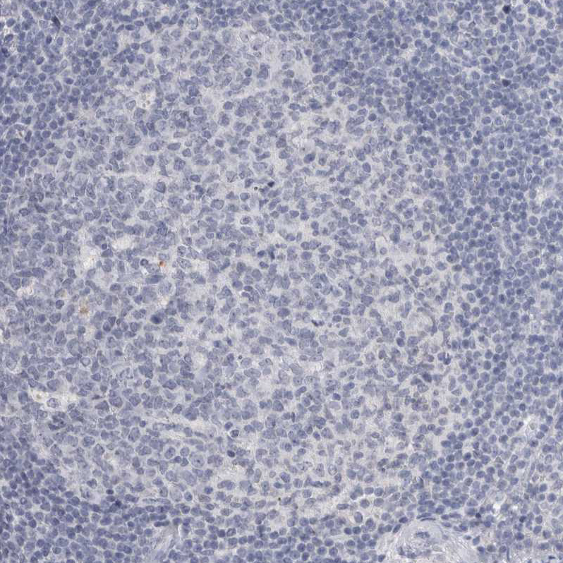 Rabbit Polyclonal Anti-ADAM2 Antibody - Buy for research - Highly ...