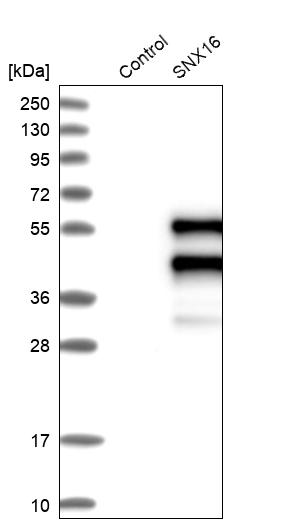 Rabbit Polyclonal Anti-SNX16 Antibody - Buy for research - Highly specific, rigorously validated ...