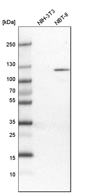 Rabbit Polyclonal Anti-PTK2B Antibody - Buy for research - Highly ...