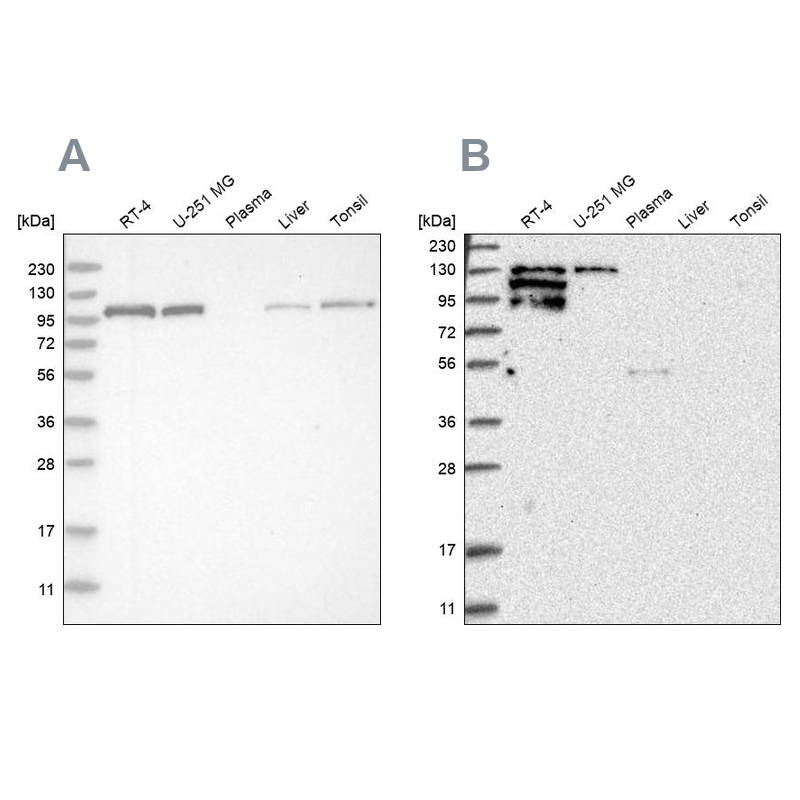 Rabbit Polyclonal Anti-PTK2B Antibody - Buy for research - Highly ...