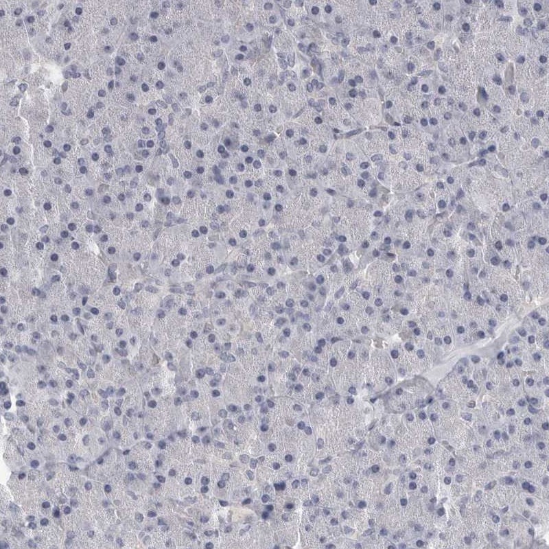 Rabbit Polyclonal Anti-DLGAP3 Antibody - Buy for research - Highly ...