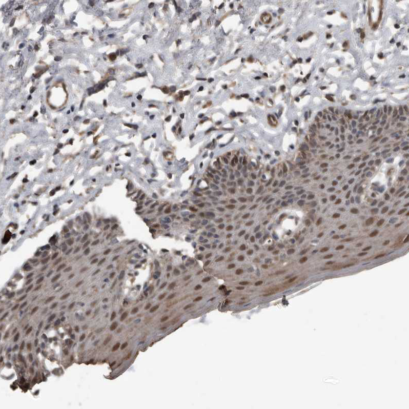 Anti-FSBP Human Protein Atlas Antibody