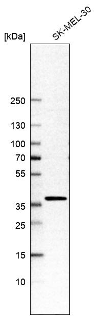 Anti-FSBP Human Protein Atlas Antibody