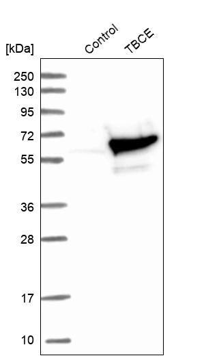 Anti-TBCE Human Protein Atlas Antibody