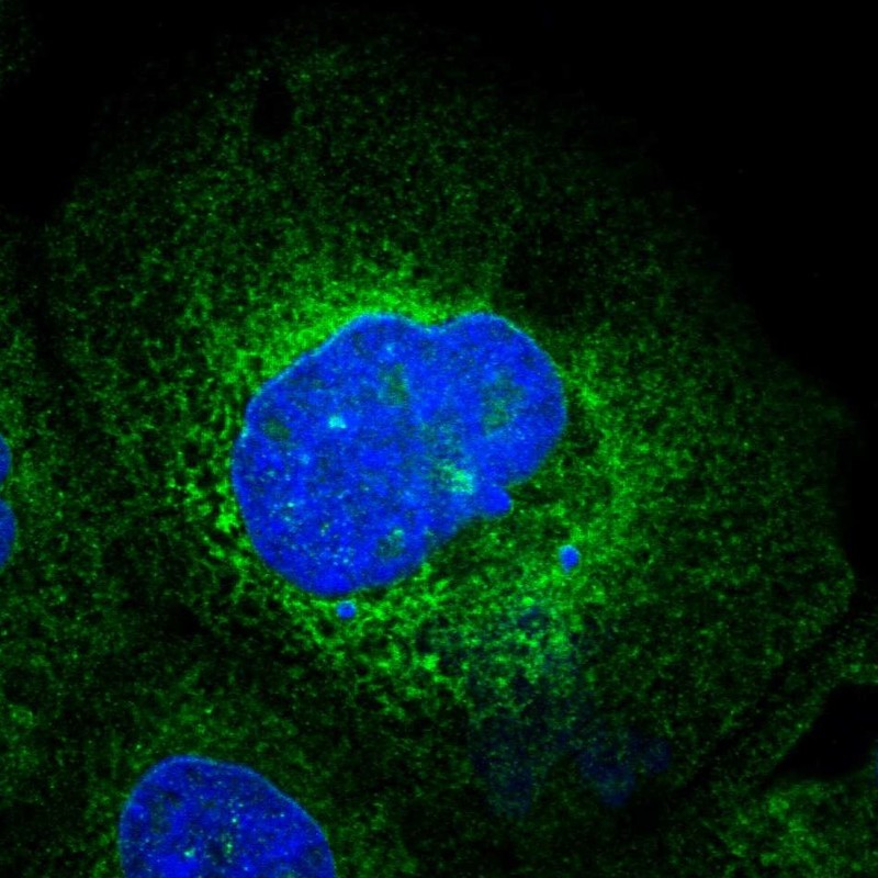 Rabbit Polyclonal Anti-RPN1 Antibody - Buy for research - Highly ...