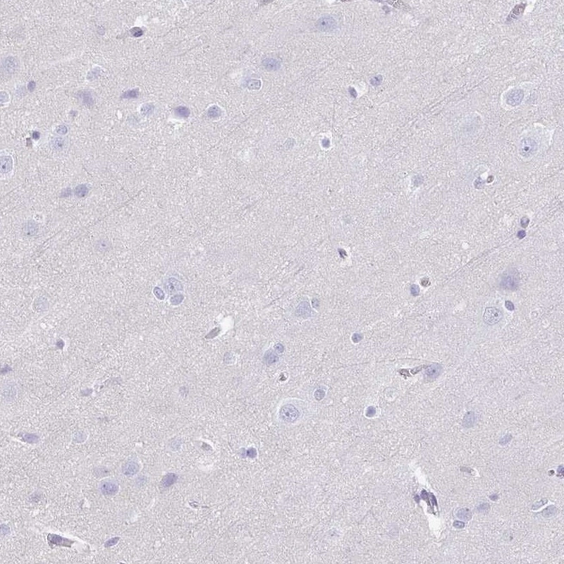 Anti-GPR182 Human Protein Atlas Antibody
