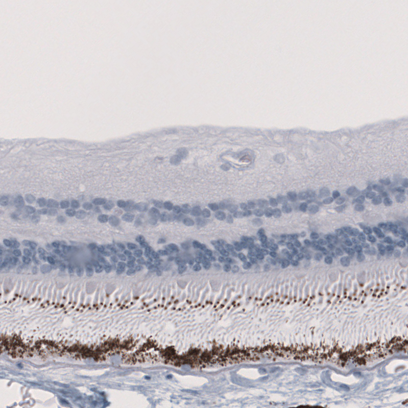 Anti-EYS Human Protein Atlas Antibody