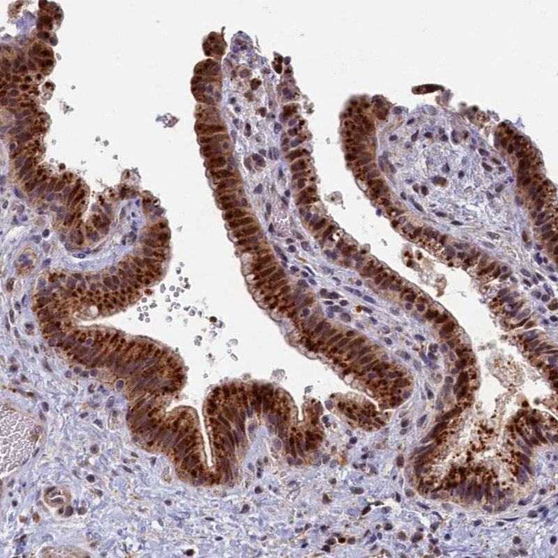 Anti-HUNK Human Protein Atlas Antibody