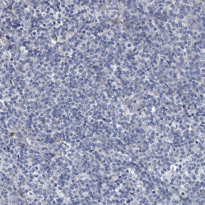 Anti-SPP1 Human Protein Atlas Antibody