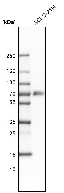 Rabbit Polyclonal Anti-TNFRSF11A Antibody - Buy for research - Highly ...