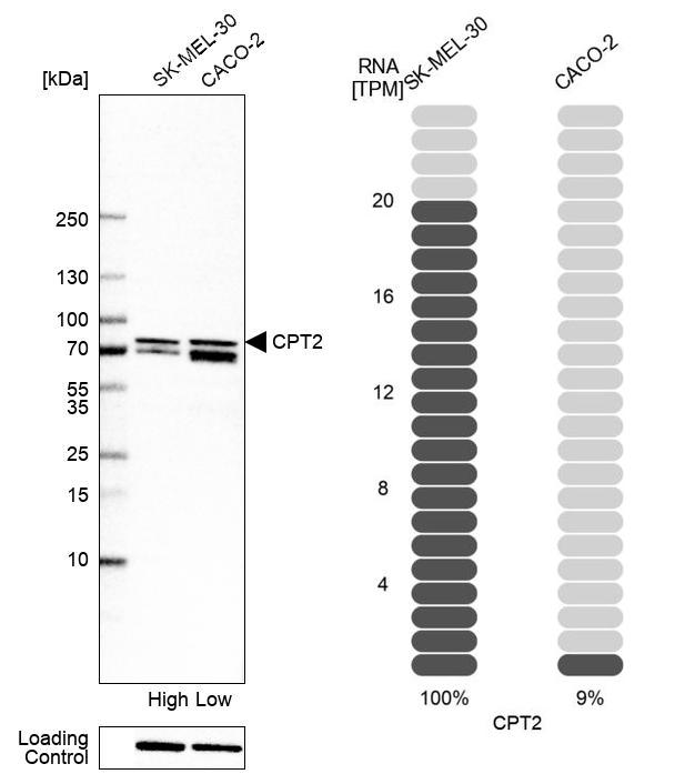Rabbit Polyclonal Anti-CPT2 Antibody - Buy for research - Highly ...