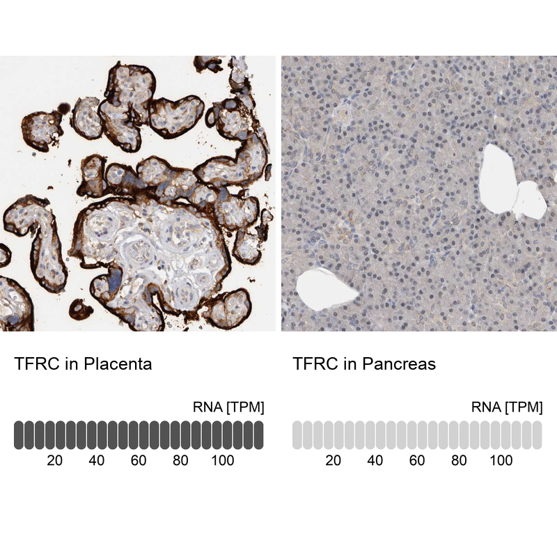 Anti-TFRC Human Protein Atlas Antibody