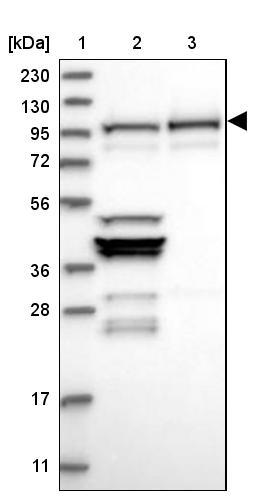 Rabbit Polyclonal Anti-NVL Antibody - Buy for research - Highly specific, rigorously validated ...