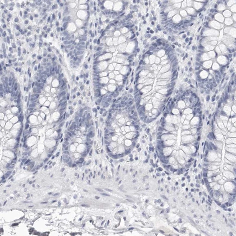 Anti-LPO Human Protein Atlas Antibody