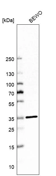 Rabbit Polyclonal Anti-MARC1 Antibody - Buy for research - Highly ...