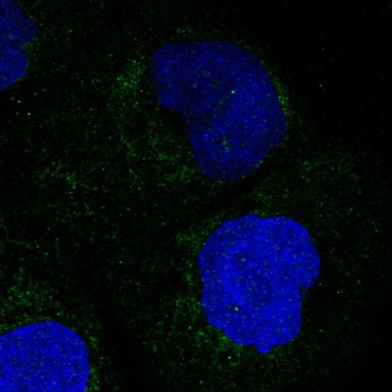 Rabbit Polyclonal Anti-MARC1 Antibody - Buy for research - Highly ...