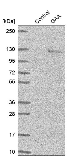 Anti-GAA Human Protein Atlas Antibody