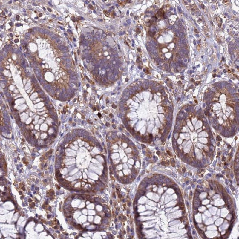Anti-RNF215 Human Protein Atlas Antibody