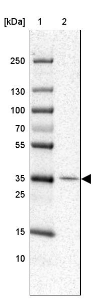 Anti-RNF217 Human Protein Atlas Antibody