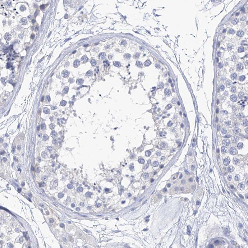 Anti-PIK3C2B Human Protein Atlas Antibody