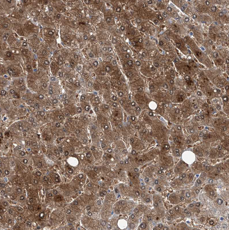 Rabbit Polyclonal Anti-GPT Antibody - Buy for research - Highly ...
