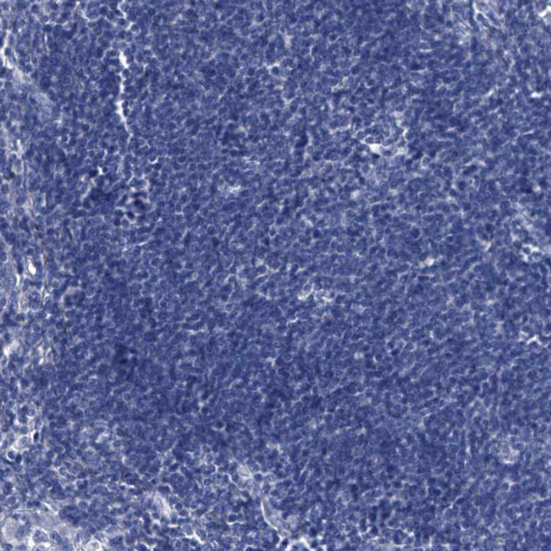 Rabbit Polyclonal Anti-GPT Antibody - Buy for research - Highly ...