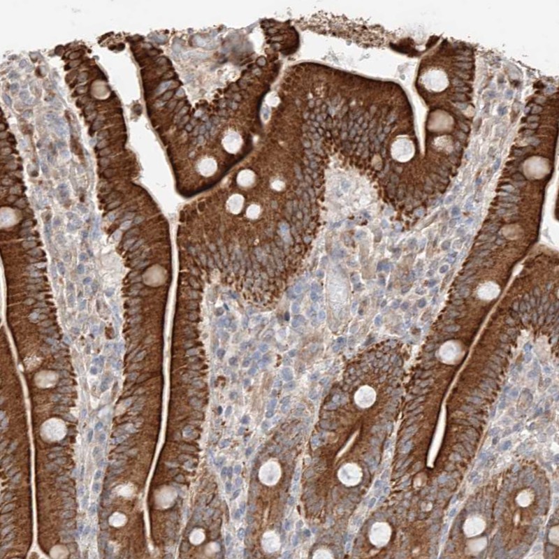 Rabbit Polyclonal Anti-GCNT1 Antibody - Buy for research - Highly ...