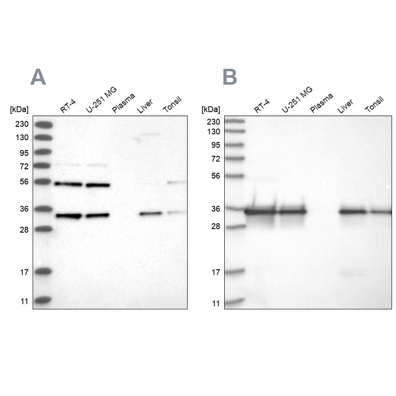 Rabbit Polyclonal Anti-PPA2 Antibody - Buy for research - Highly specific, rigorously validated ...