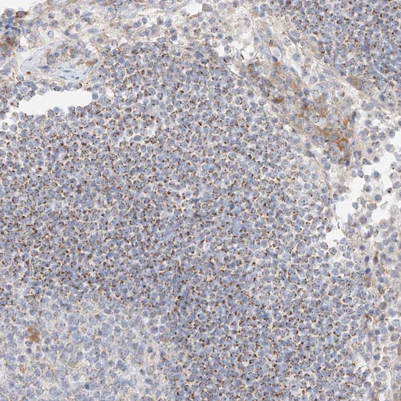 Rabbit Polyclonal Anti-UST Antibody - Buy for research - Highly specific, rigorously validated ...