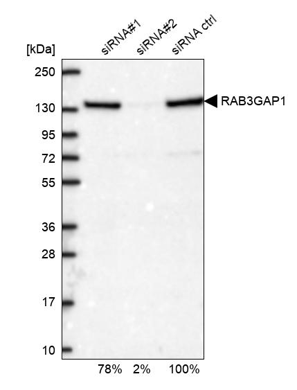 Rabbit Polyclonal Anti-RAB3GAP1 Antibody - Buy for research - Highly ...