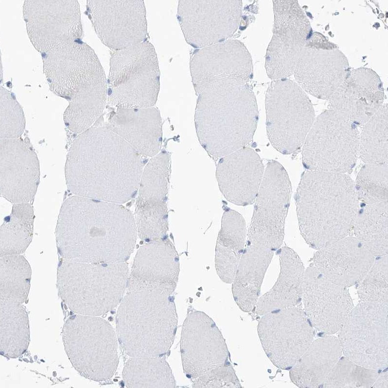 Rabbit Polyclonal Anti-PSD4 Antibody - Buy for research - Highly specific, rigorously validated ...