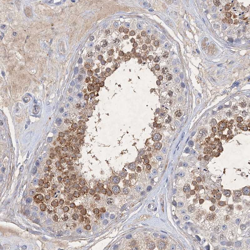 Rabbit Polyclonal Anti-C11orf58 Antibody - Buy for research - Highly ...