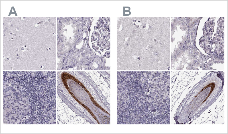 Immunohistochemistry - Atlas Antibodies
