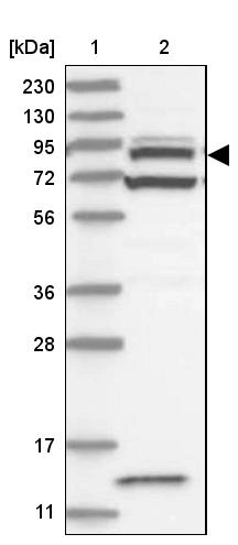 Rabbit Polyclonal Anti-ACAP2 Antibody - Buy for research - Highly ...