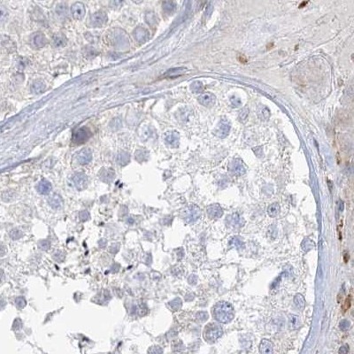 Rabbit Polyclonal Anti-HAAO Antibody - Buy for research - Highly ...