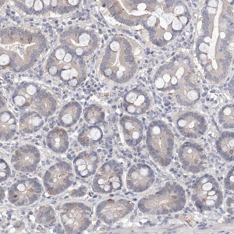 Rabbit Polyclonal Anti-DPCD Antibody - Buy for research - Highly ...